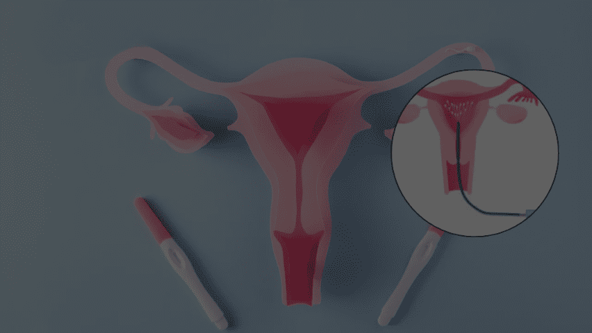 Pregnancy test after IUI: Best Time & Accuracy Guide